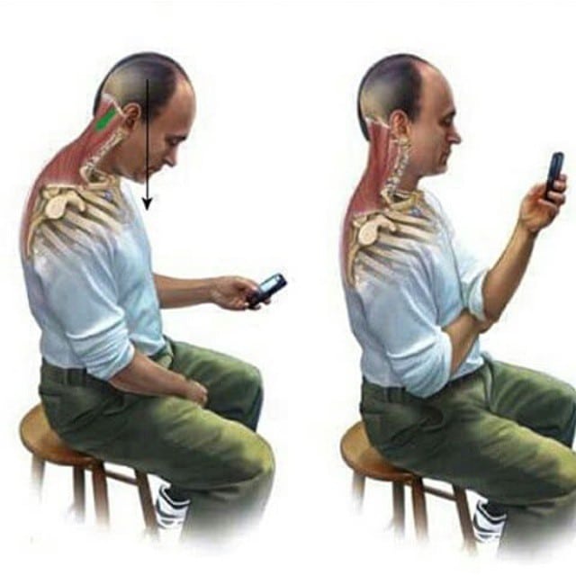 Lesão na cervical pode ser causado pela má postura ao manusear os ...